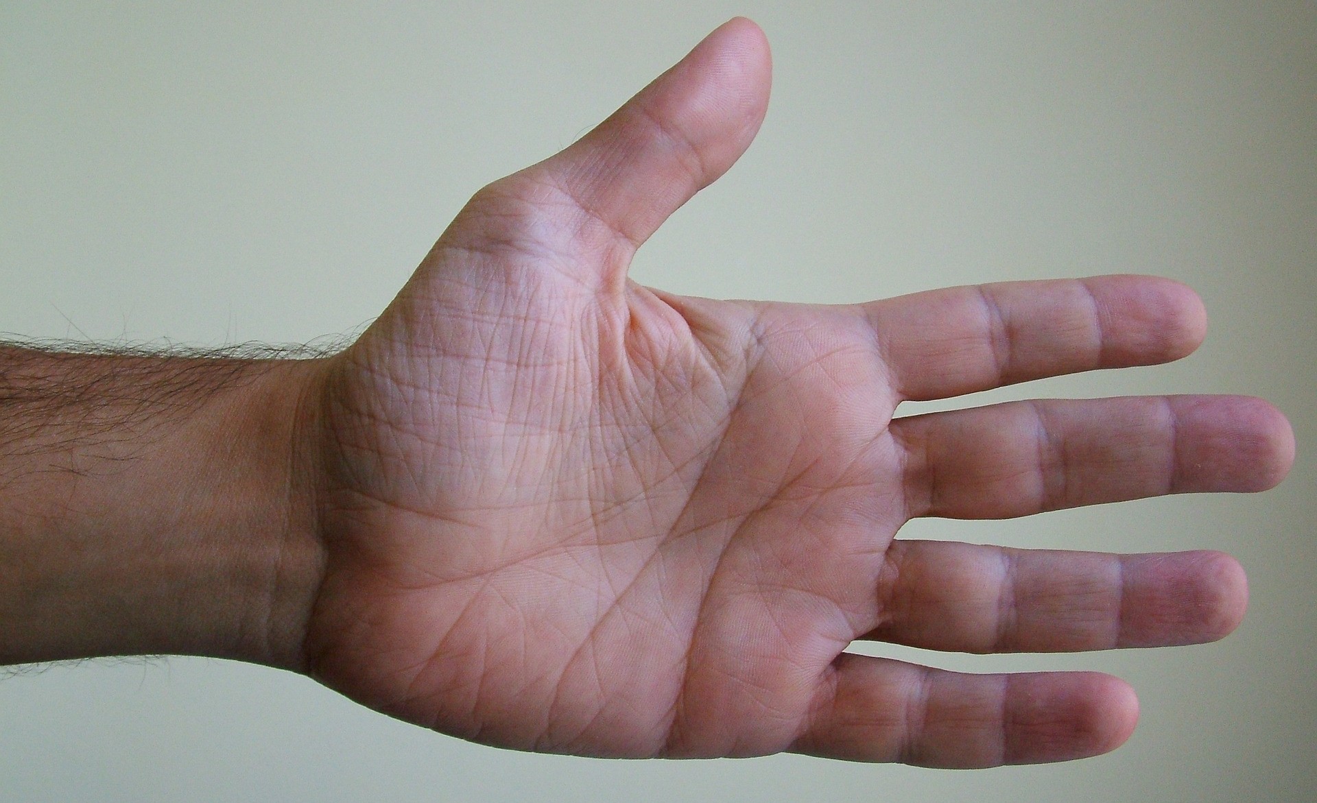 “I Don’t Need A Doctor,” Says Man Whose Hand Fell Off – The Third Spur